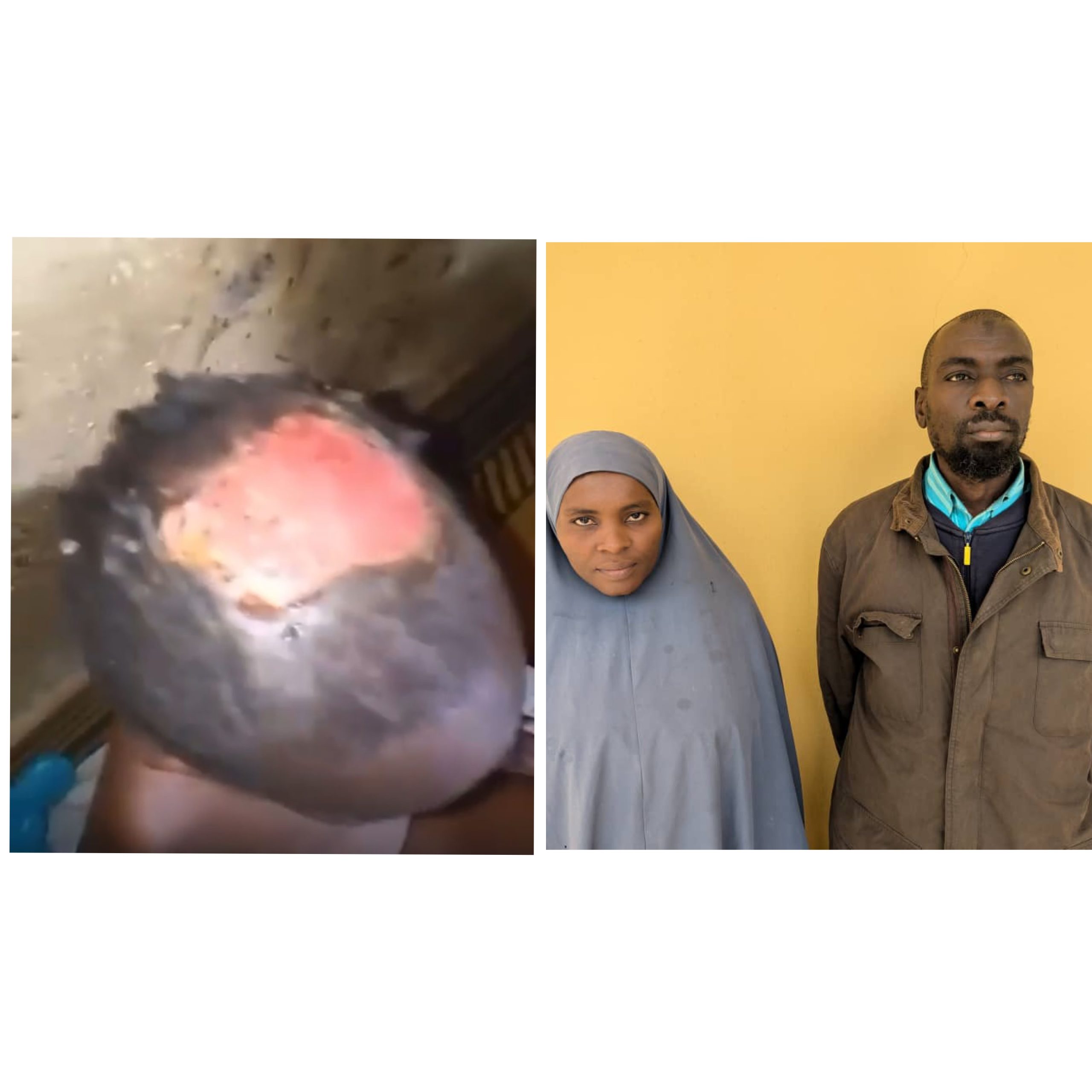 Woman arrested for setting step-daughter’s hair on fire - Naija police ...